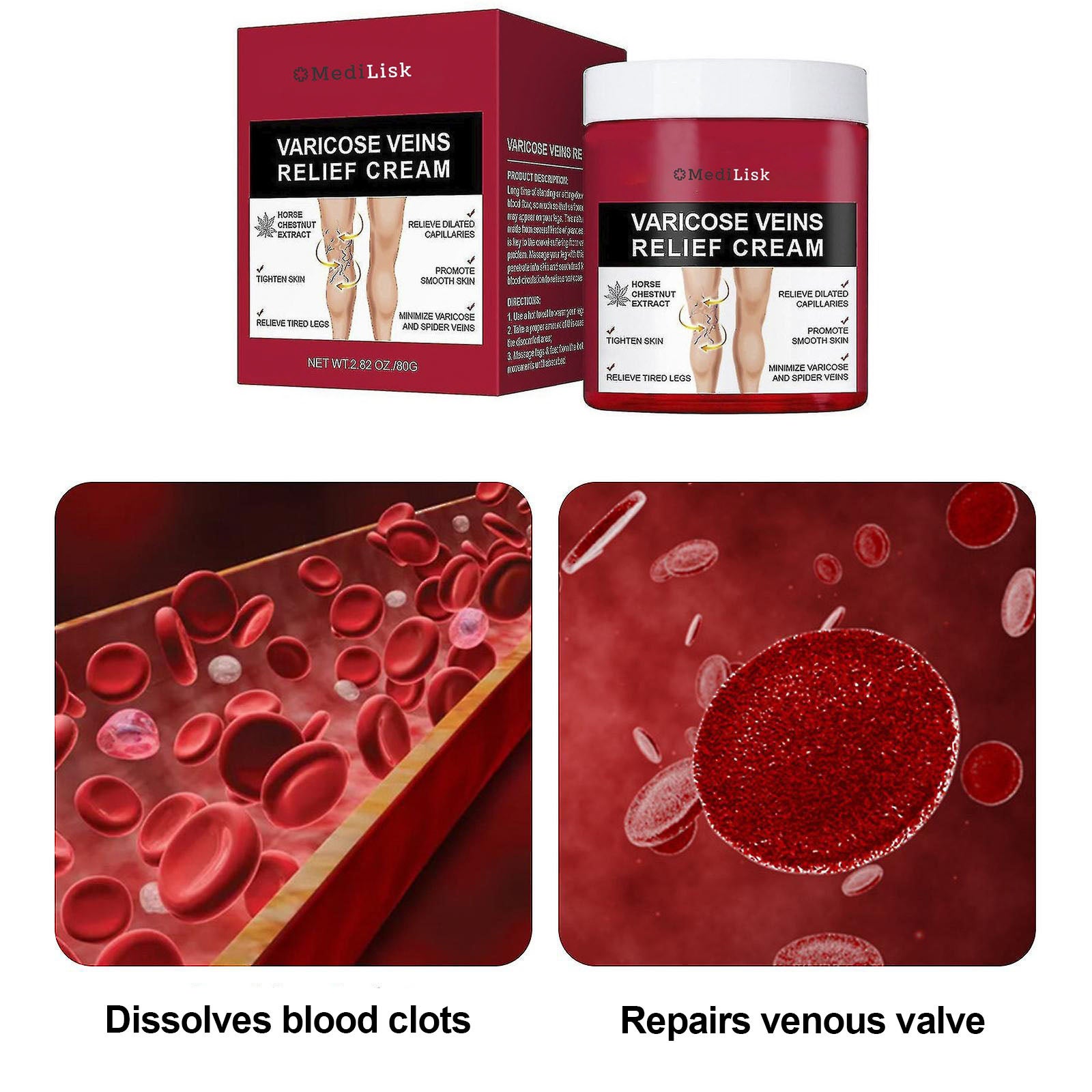 Varicose Veins Relief Cream MediLisk™