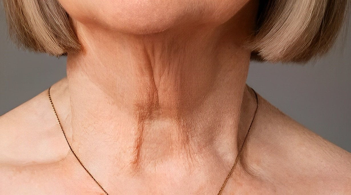 How I Got Rid of Neck Wrinkles in 4 Weeks!