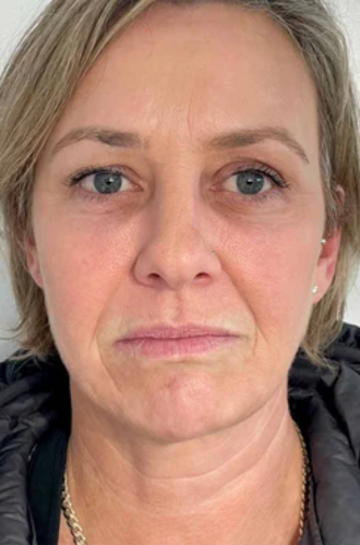 Bliss Elixir (Buy 2 Get 4) – Bliss Cosmetics