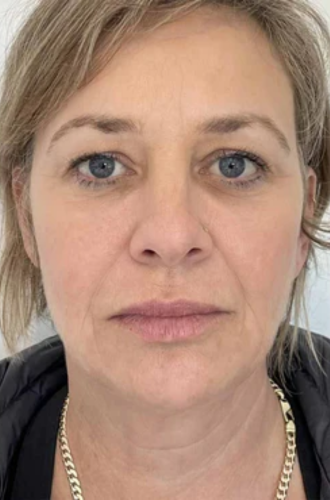 Bliss Elixir (Buy 2 Get 4) – Bliss Cosmetics