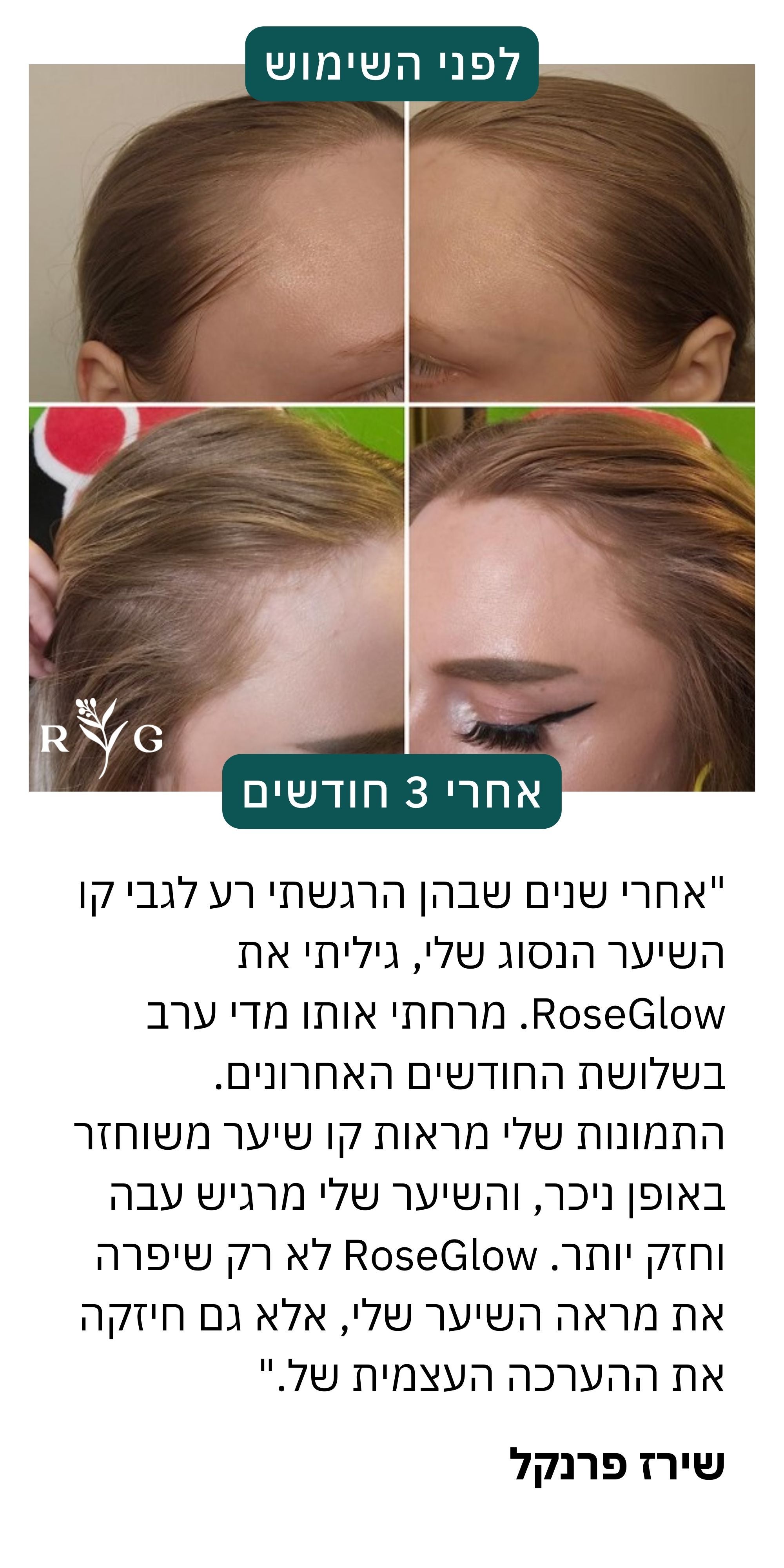 RoseGlow - שמן רוזמרין לנשירת שיער
