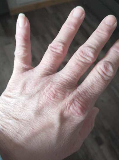 VitaNerva® - Volledig natuurlijke crème om neuropathie in 7 dagen om te ...