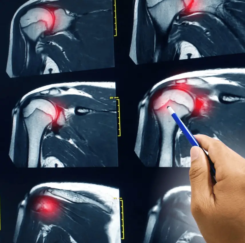 Reliefly 3-in-1 Shoulder Device – Helps Alleviate Pain and Stiffness i ...