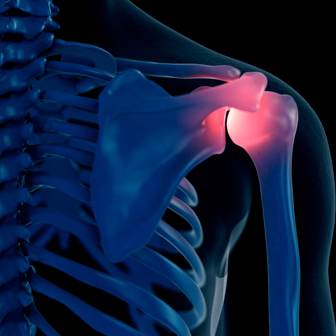 RelieflyLab 3-in-1 Shoulder Device