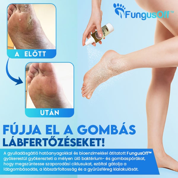 FungusOff™ Gyors & Természetes Lábgomba-Eltávolító ...