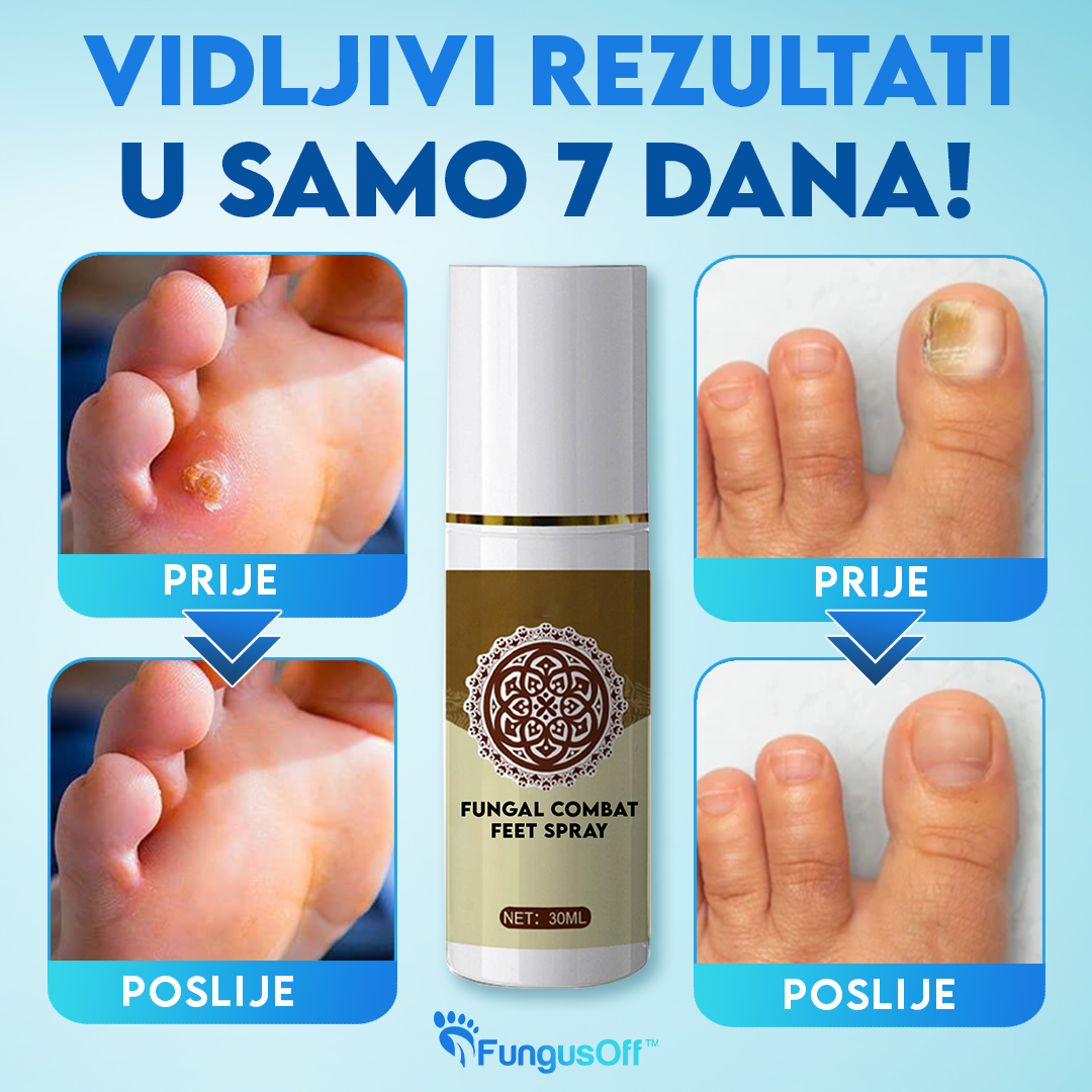 FungusOff™ Rychlý a Přírodní Odstraňovač Plísní na Nohou – BestBrandsCzech