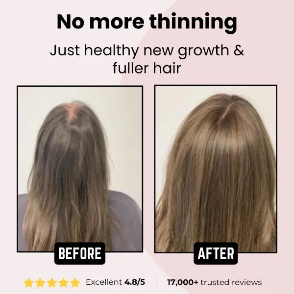 H-Regrow Special Offer