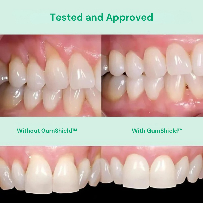 GumShield™