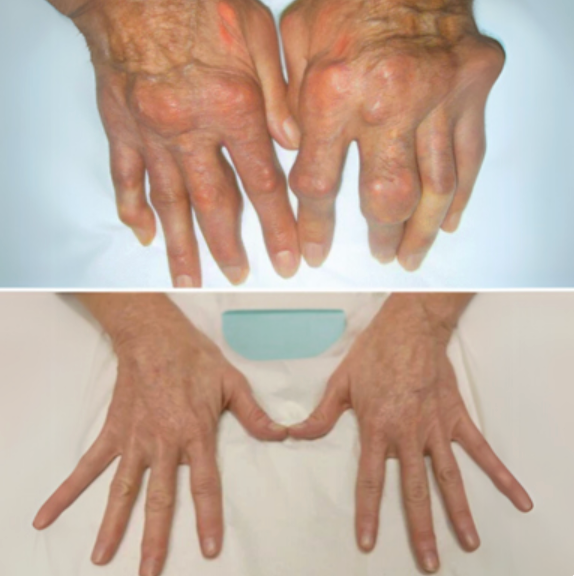 Surnea | Gel articulations